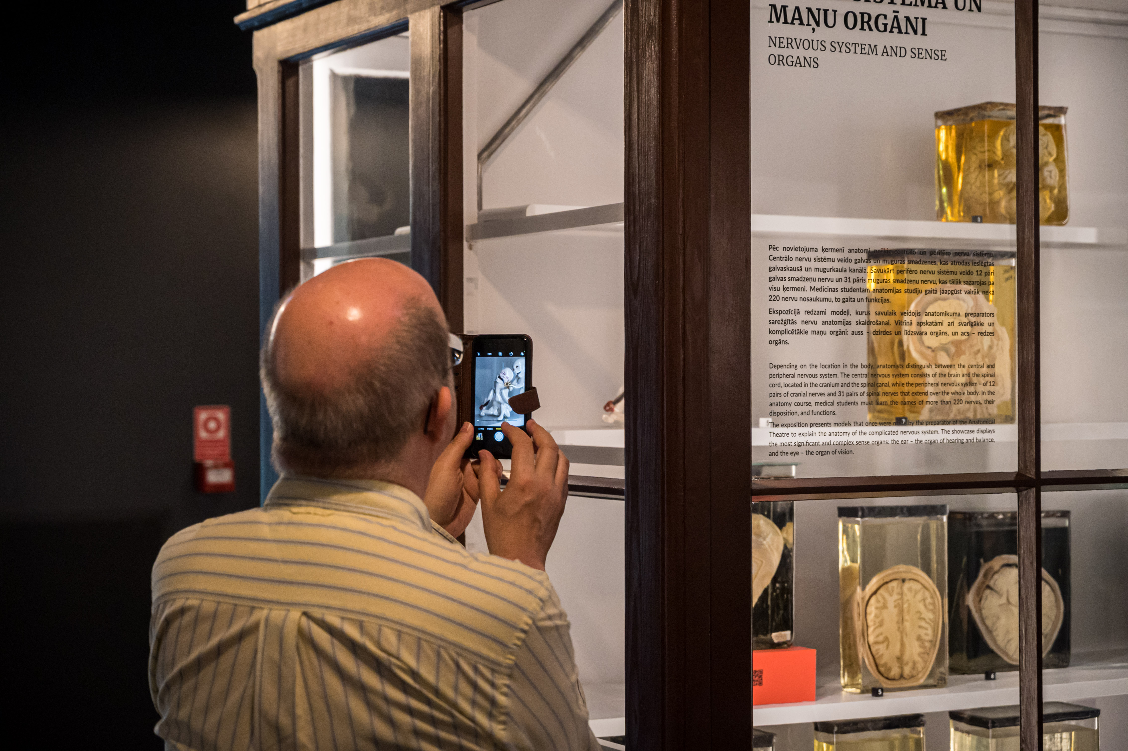 Exhibition by British Ceramicist Paddy Hartley Opens at RSU Anatomy Museum