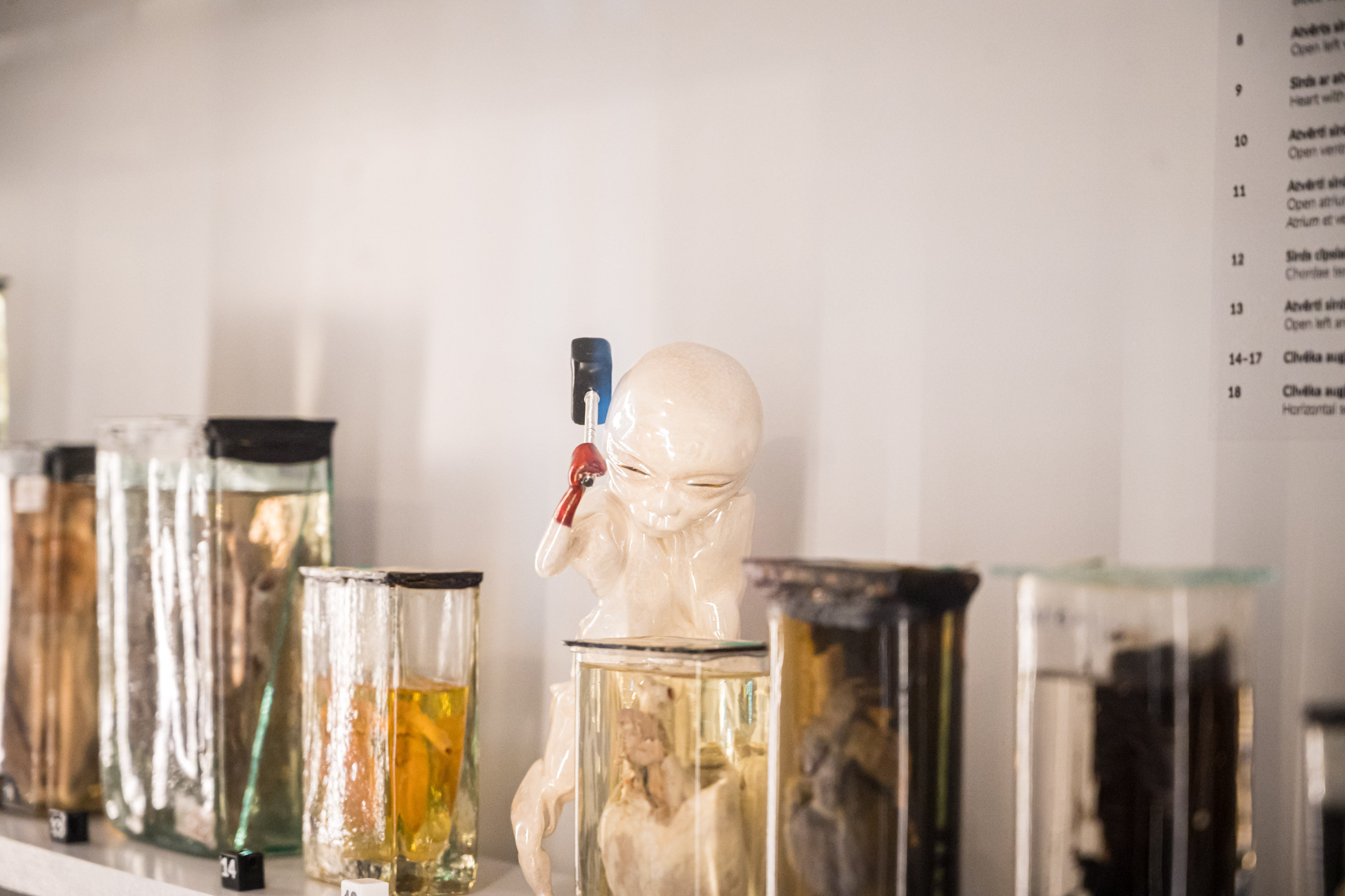 Exhibition by British Ceramicist Paddy Hartley Opens at RSU Anatomy Museum