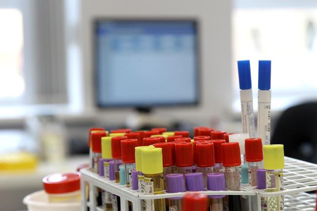 Research On Differences In Microbial Translocation Markers And Faecal Microbiota In Hiv And Hcv